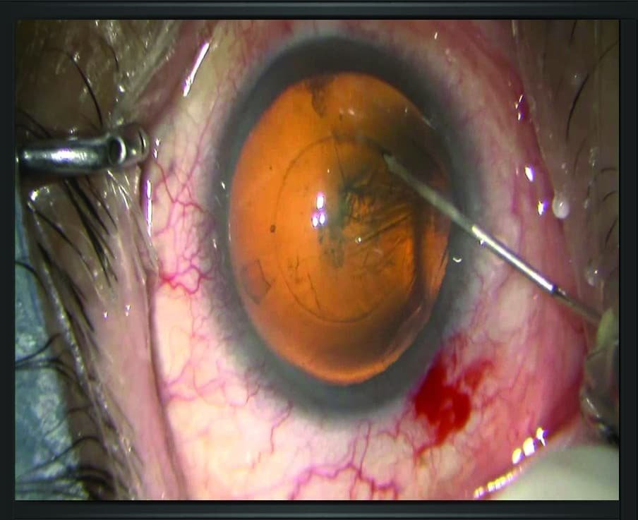 Buy Stella Ophthalmic Microscope Floor Mount